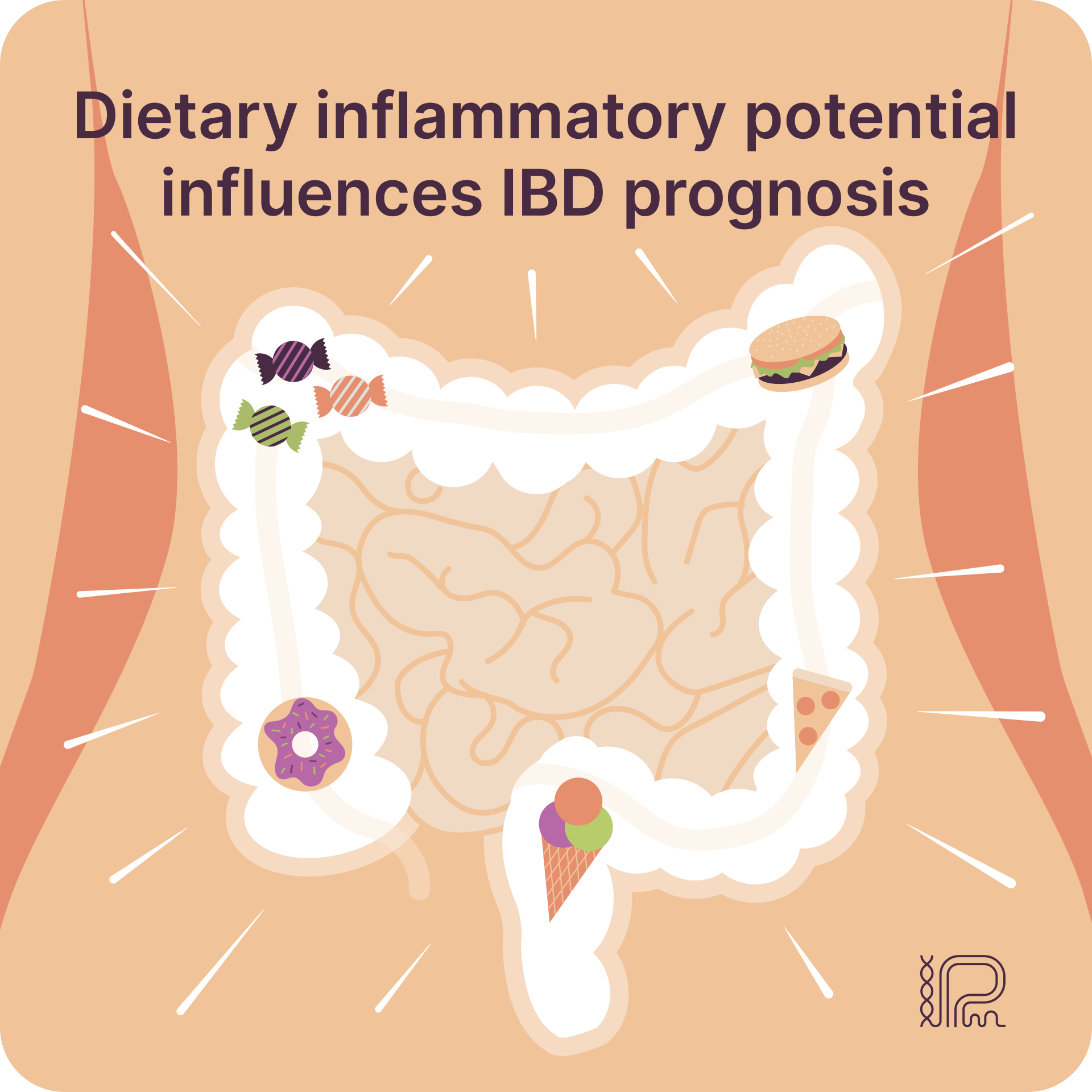 New study: Dietary inflammatory potential influences IBD prognosis